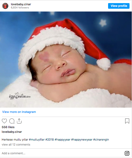 Baby born with ‘heart’ birthmark became world famous in 2015 – here’s ...