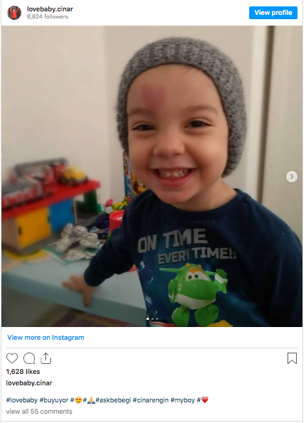 Baby born with ‘heart’ birthmark became world famous in 2015 – here’s ...