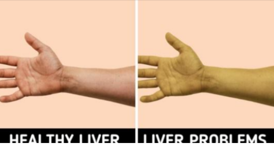 8 Body Symptoms You Should Be Aware Of - Story Url